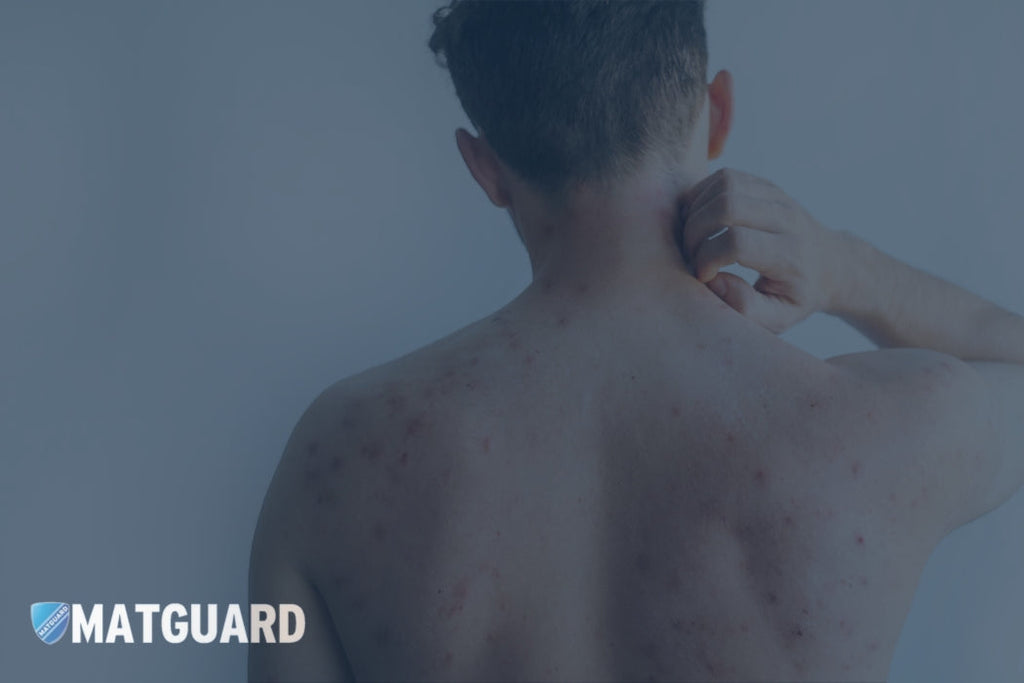 Pimple That Isn’t a Pimple: Red Flags | Matguard USA | Matguard